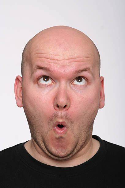 Justiça decide que chamar alguém de ‘careca’ pode ser considerado ...